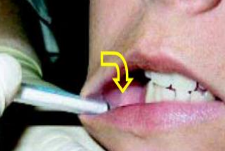 Cómo dar medicamentos por VÍA BUCAL - Cómo administrar los diferentes ...
